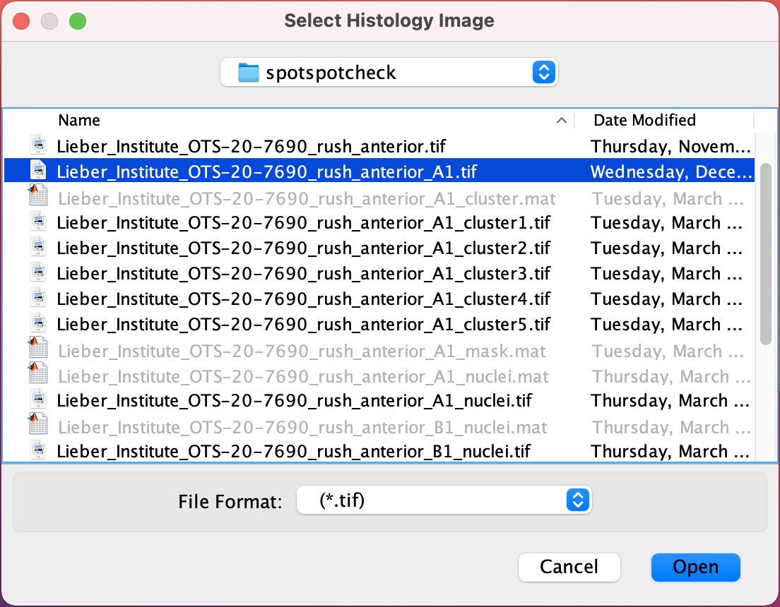 4 Step 4: GUI to count nuclei in a Visium spot | VistoSeg: Visium Histology Image Segmentation ...